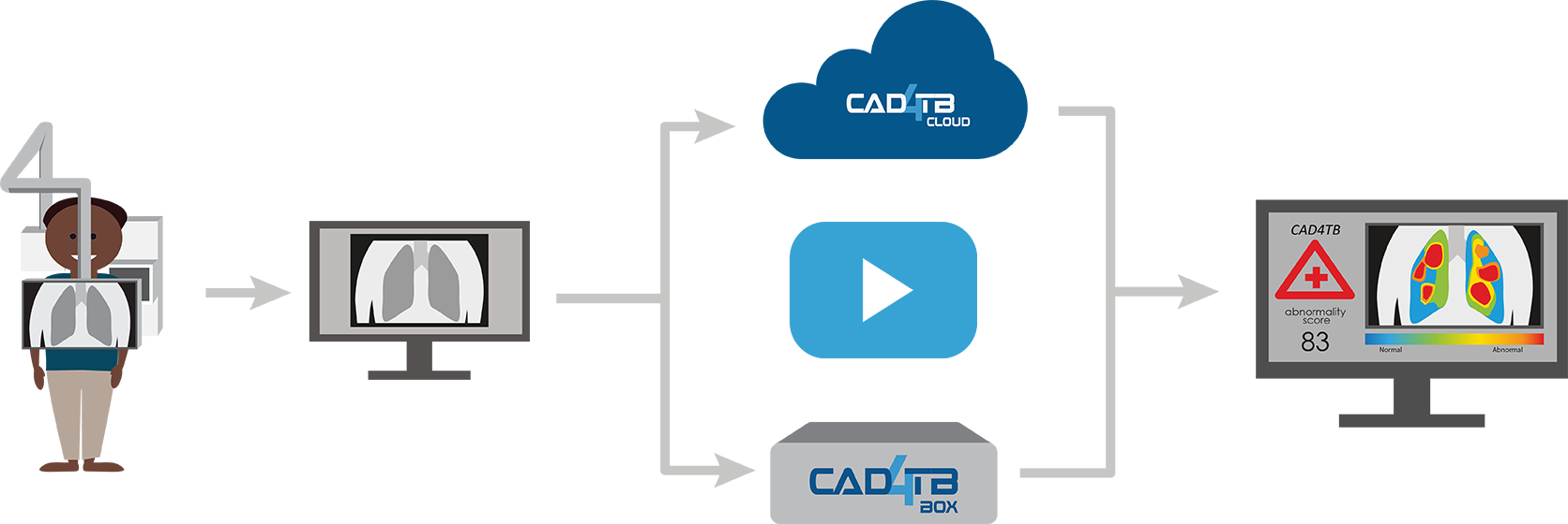 CAD4TB | Delft Imaging