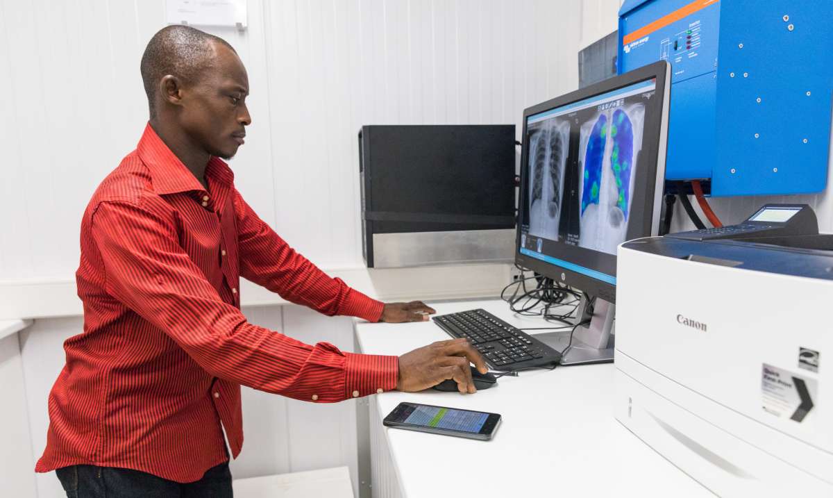 CAD4TB - Delft Imaging