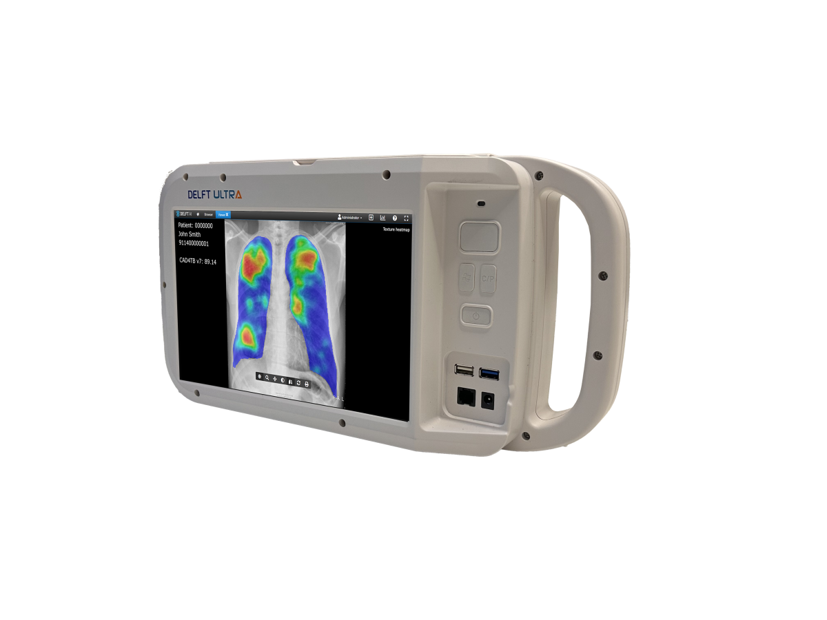 Delft Ultra: Advanced Portable Digital X-ray for TB Sreening