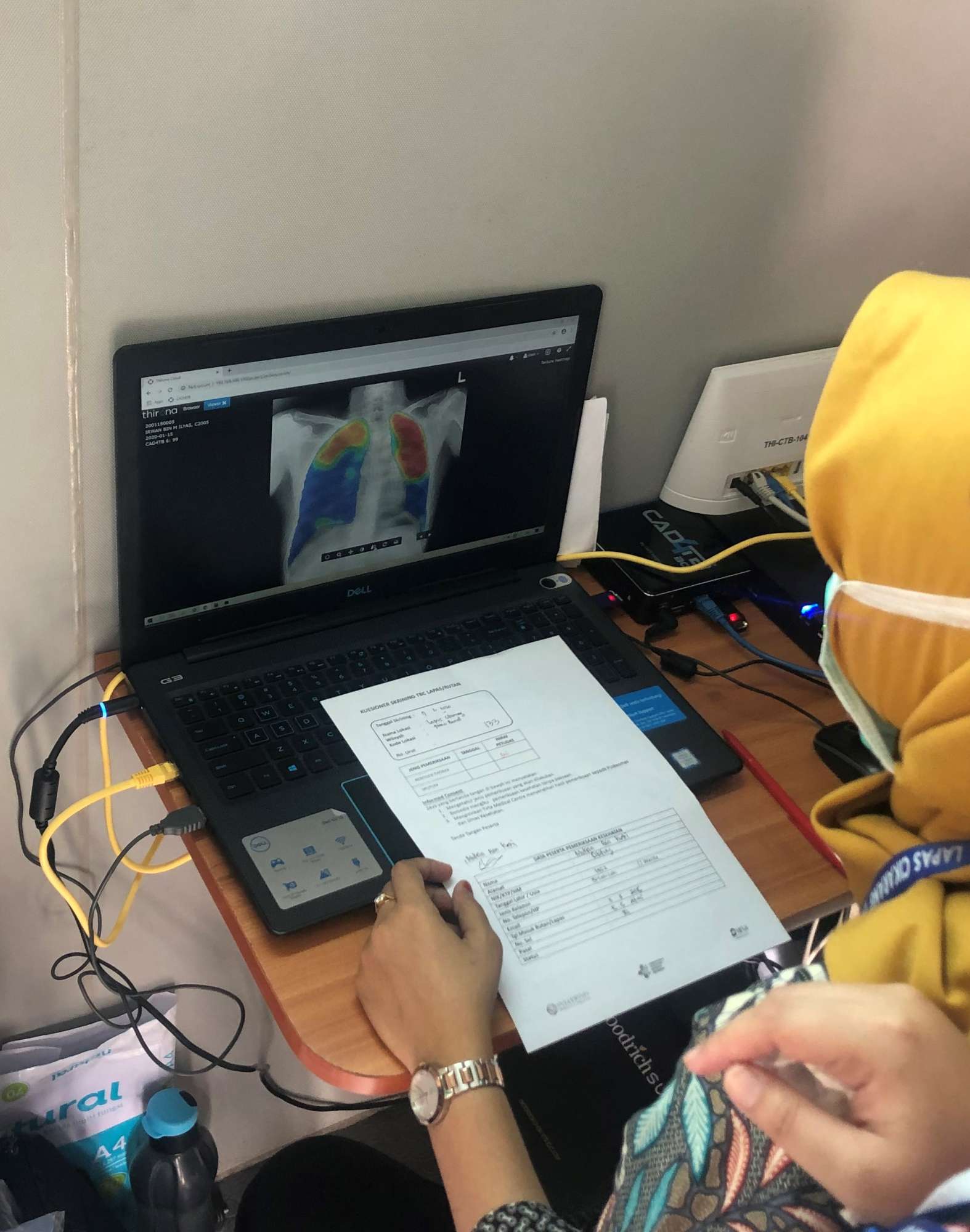 CAD4TB: AI-Powered Tuberculosis Detection Software