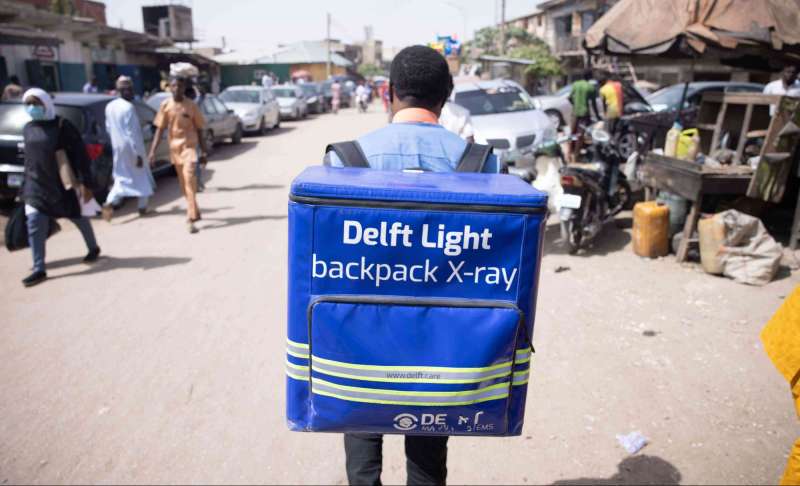 CAD4TB: AI-Powered Tuberculosis Detection Software