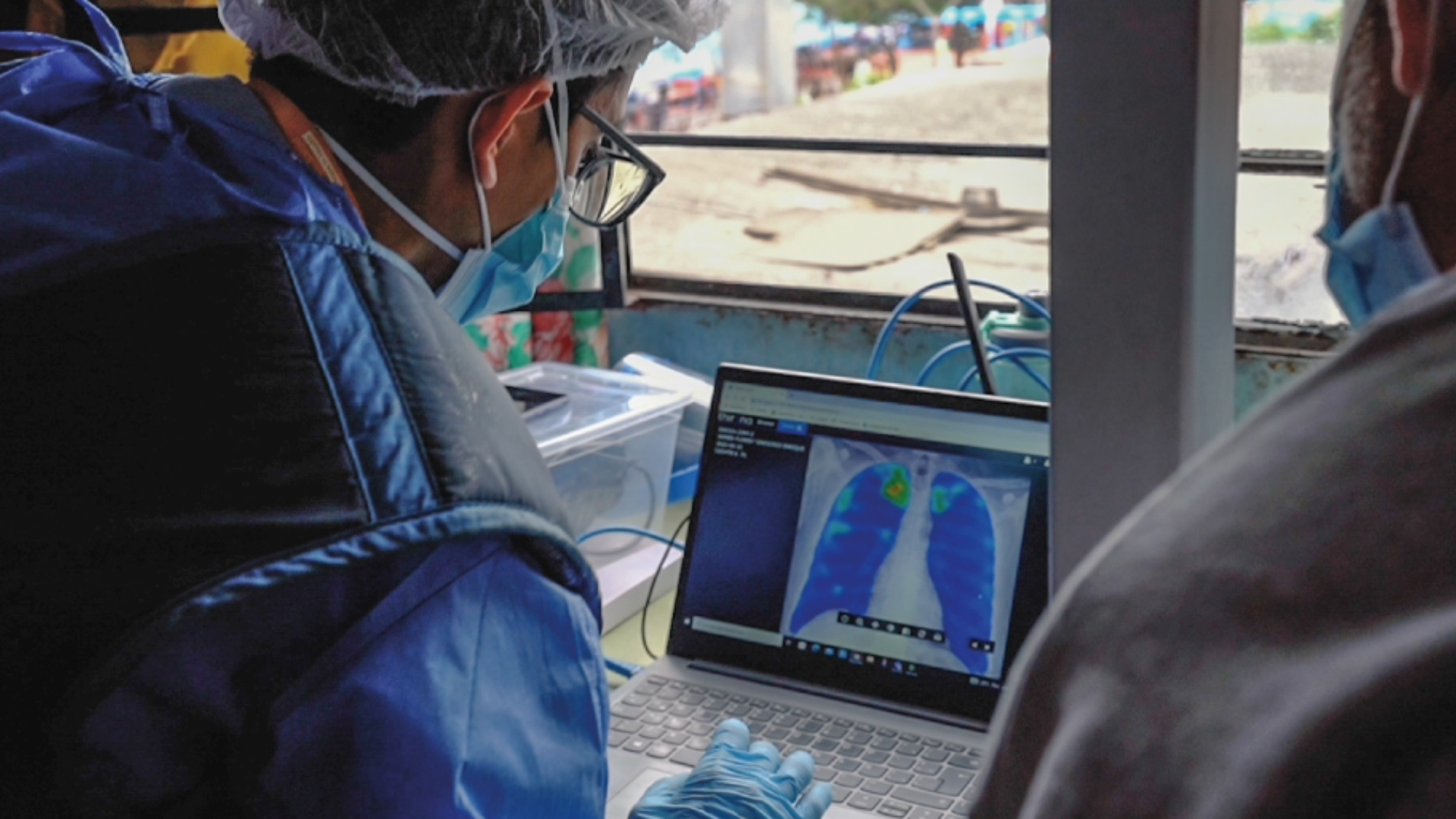 TB Active Case-Finding in Latin America using AI & Portable X-rays