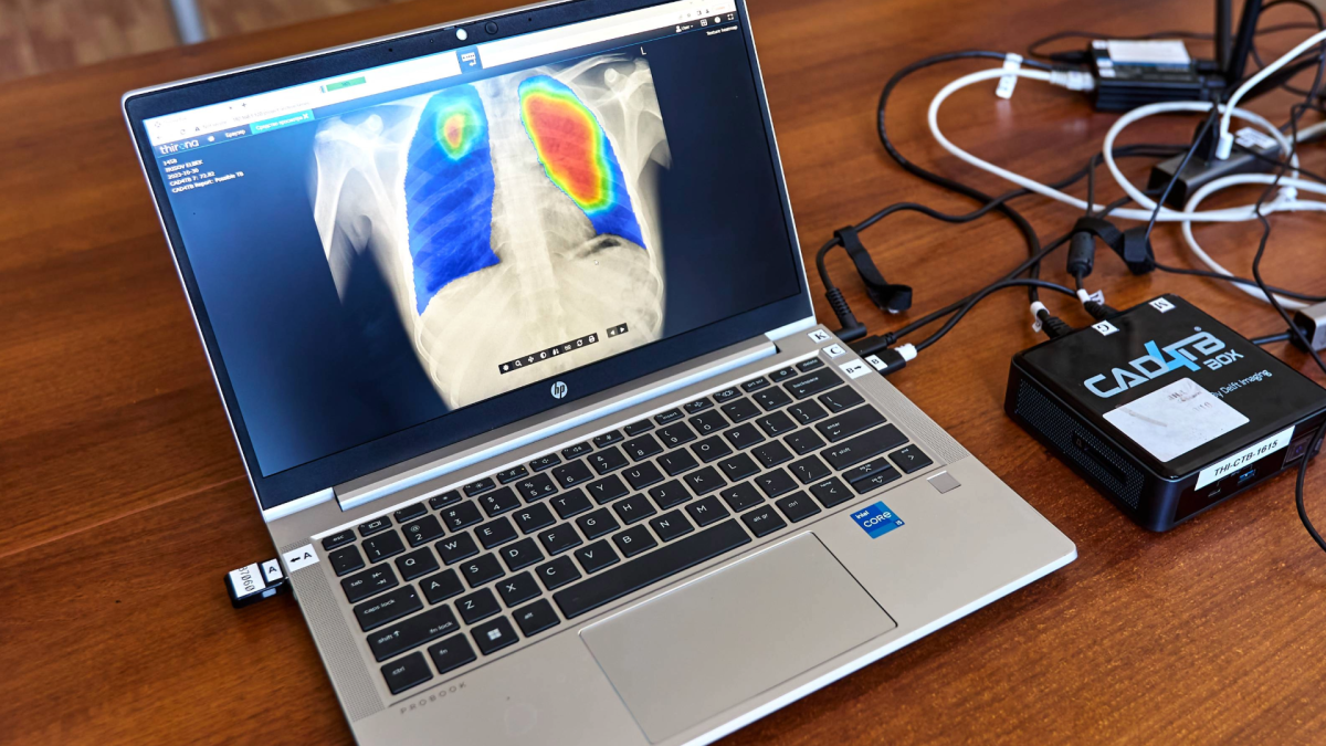 Impact Stories - Delft Imaging