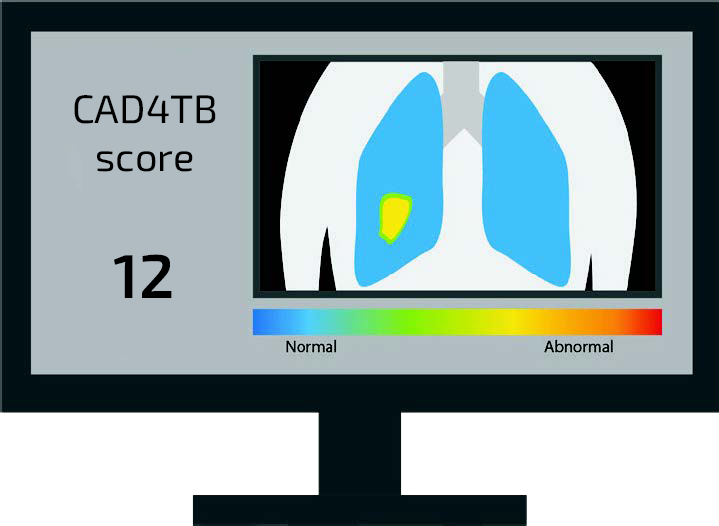 CAD4TB: AI-Powered Tuberculosis Detection Software