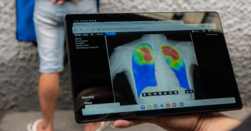 Philippines - Active TB Case-finding with CAD4TB - Delft Imaging
