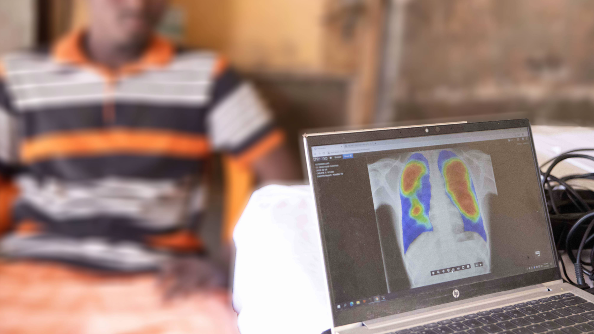 Impact Stories - Delft Imaging