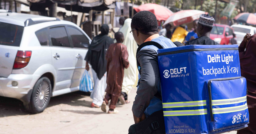 Innovating Towards Health Equity: Delft Imaging and the Evolution of TB Screening - Delft Imaging