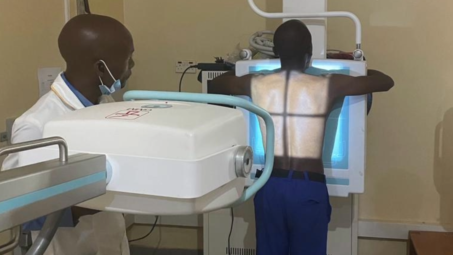 Applied AI for TB-screening in various settings