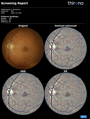 Eye Health Solutions: Advanced Imaging & AI | Delft Imaging